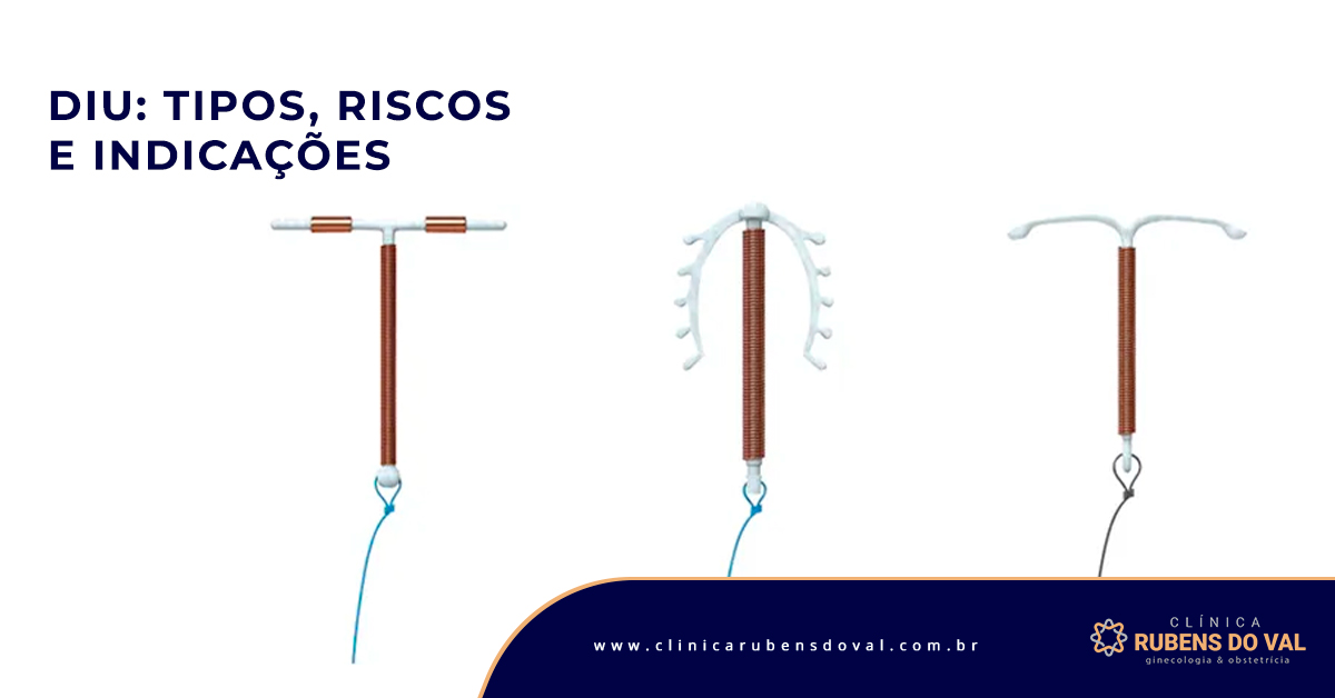 DIU: tipos, riscos e indicações - Clínica Rubens do Val CRM 58764
