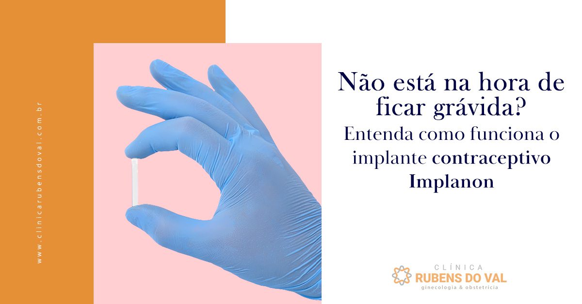 Não está na hora de ficar grávida? Entenda como funciona o implante ...
