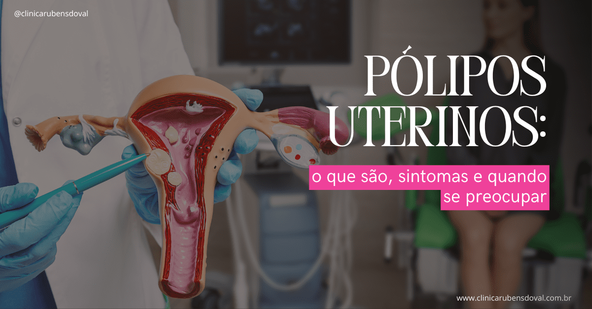 Pólipos Uterinos: o que são, sintomas e quando se preocupar - Clínica ...
