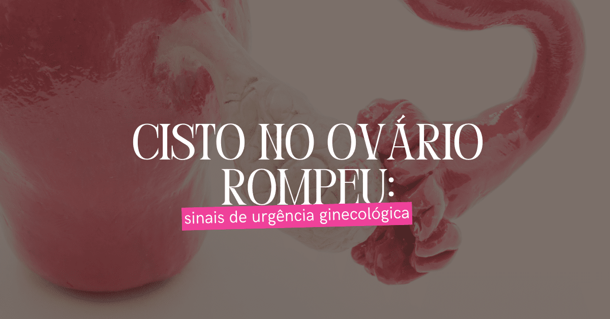 Cisto no ovário rompeu: sinais de urgência ginecológica - Clínica ...